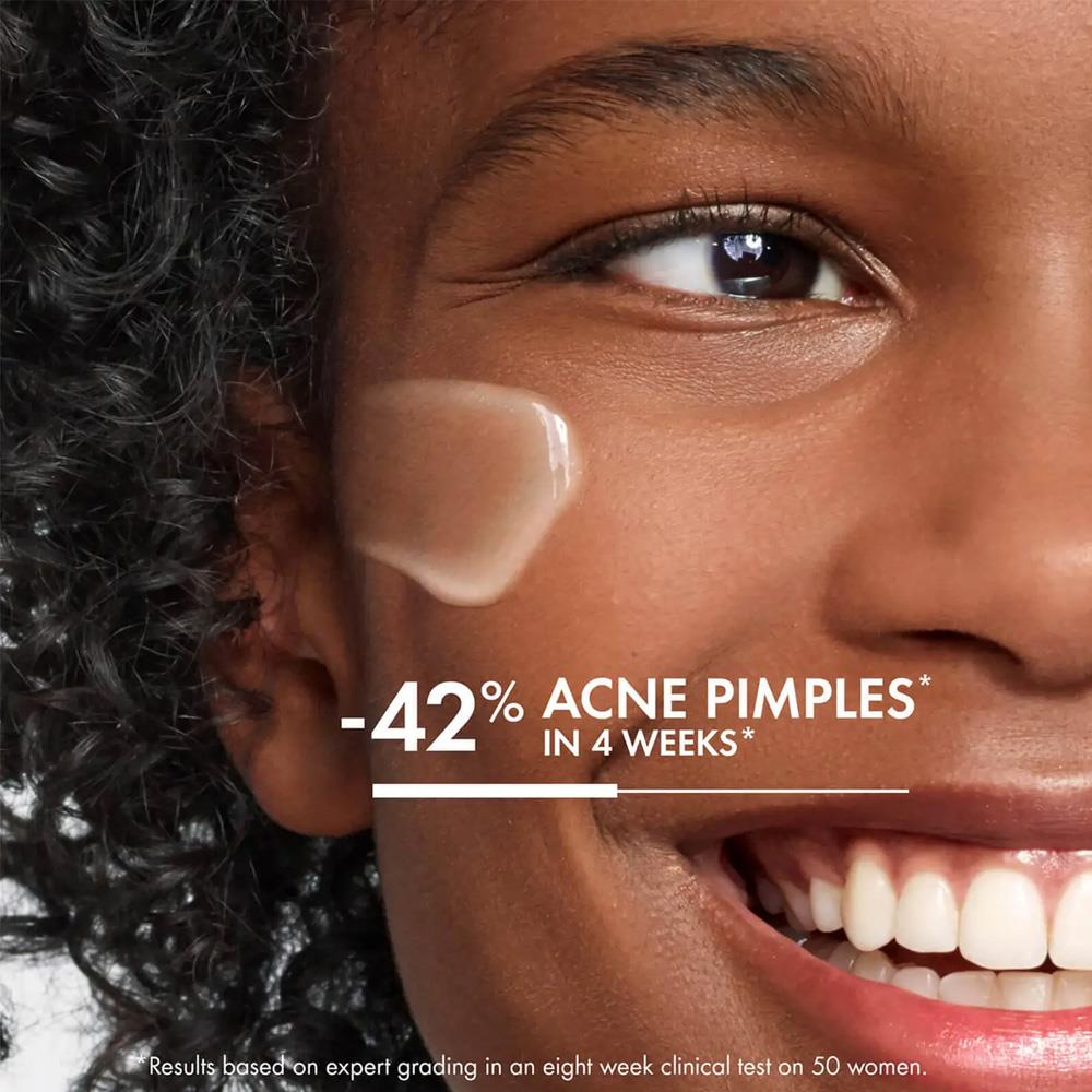 VICHY NORMADERM DOUBLE CORRECT CARE MOISTURISER 50ML | CH Tralee | Ireland