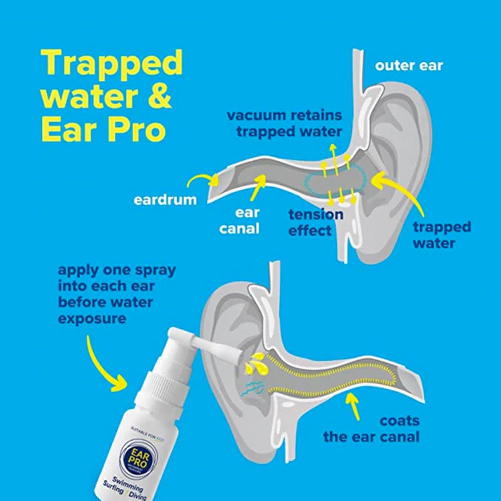 EAR PRO | CH Tralee | Ireland
