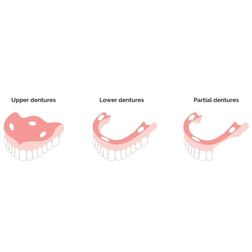 IsoDent Adhesive Cream For Dentures 40g | Inish Pharmacy | Ireland