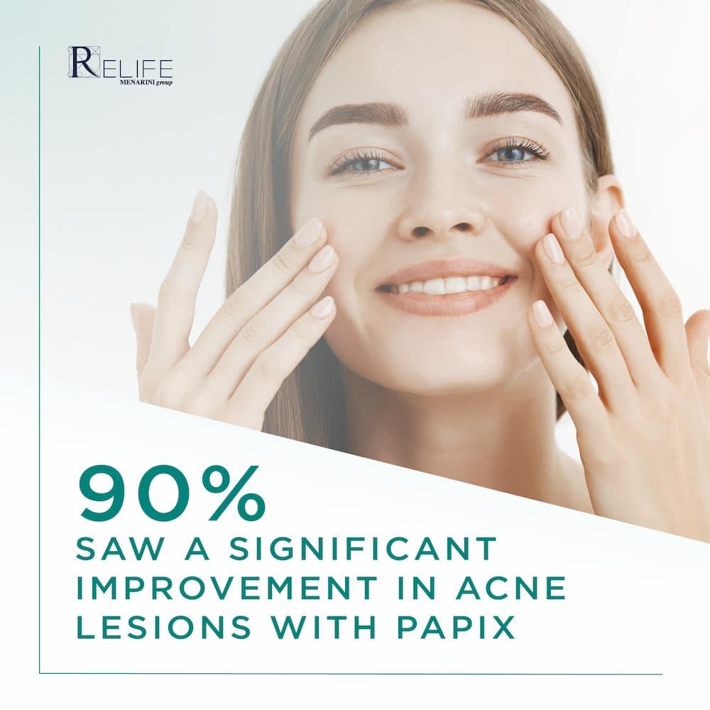 Relife PapiX Cleanser for Acne Prone Skin 200ml | Inish Pharmacy | Ireland
