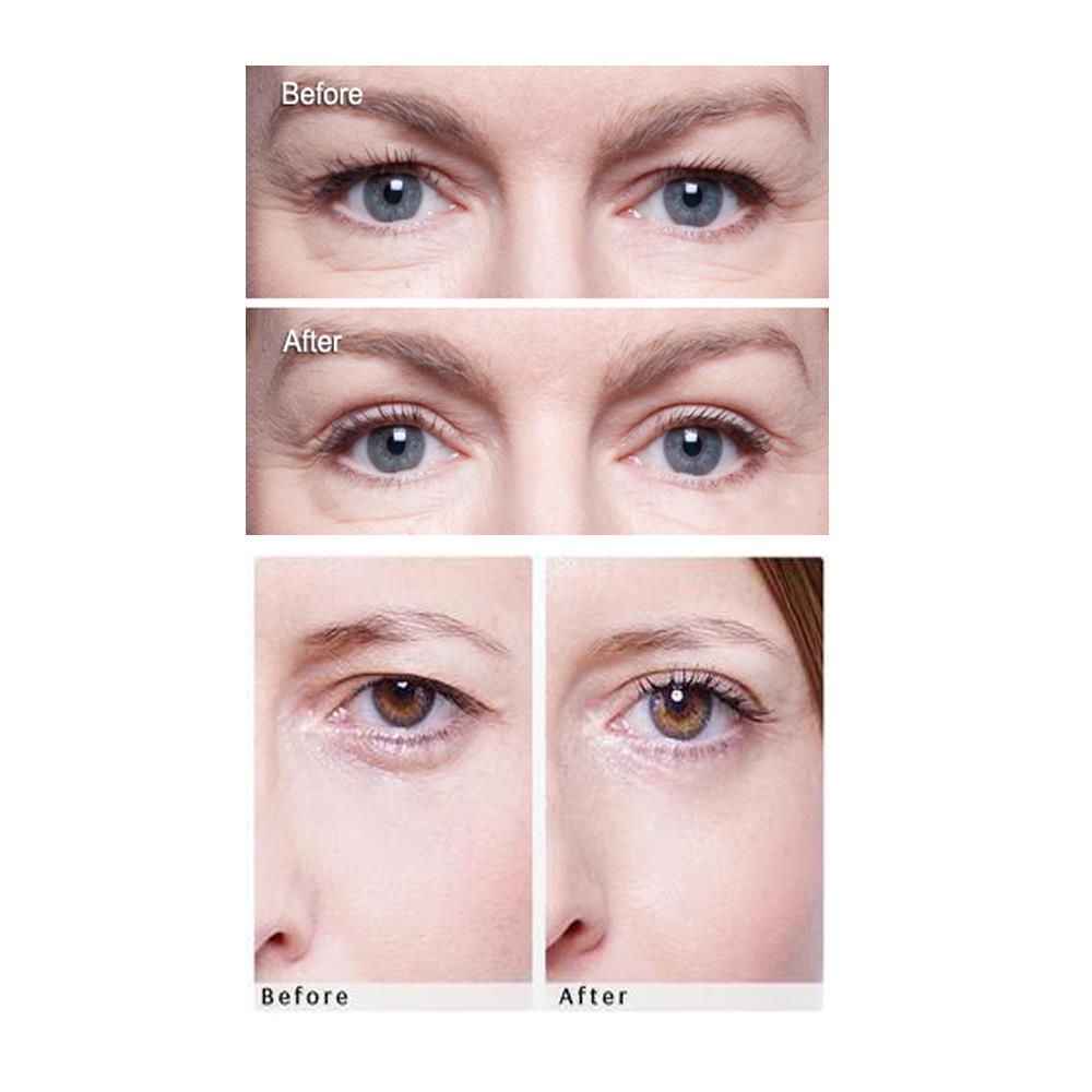Eye Lid Lift Strips - Eye Lid Lift - Instant Eyelid Lift - Hood Eye Lid ...