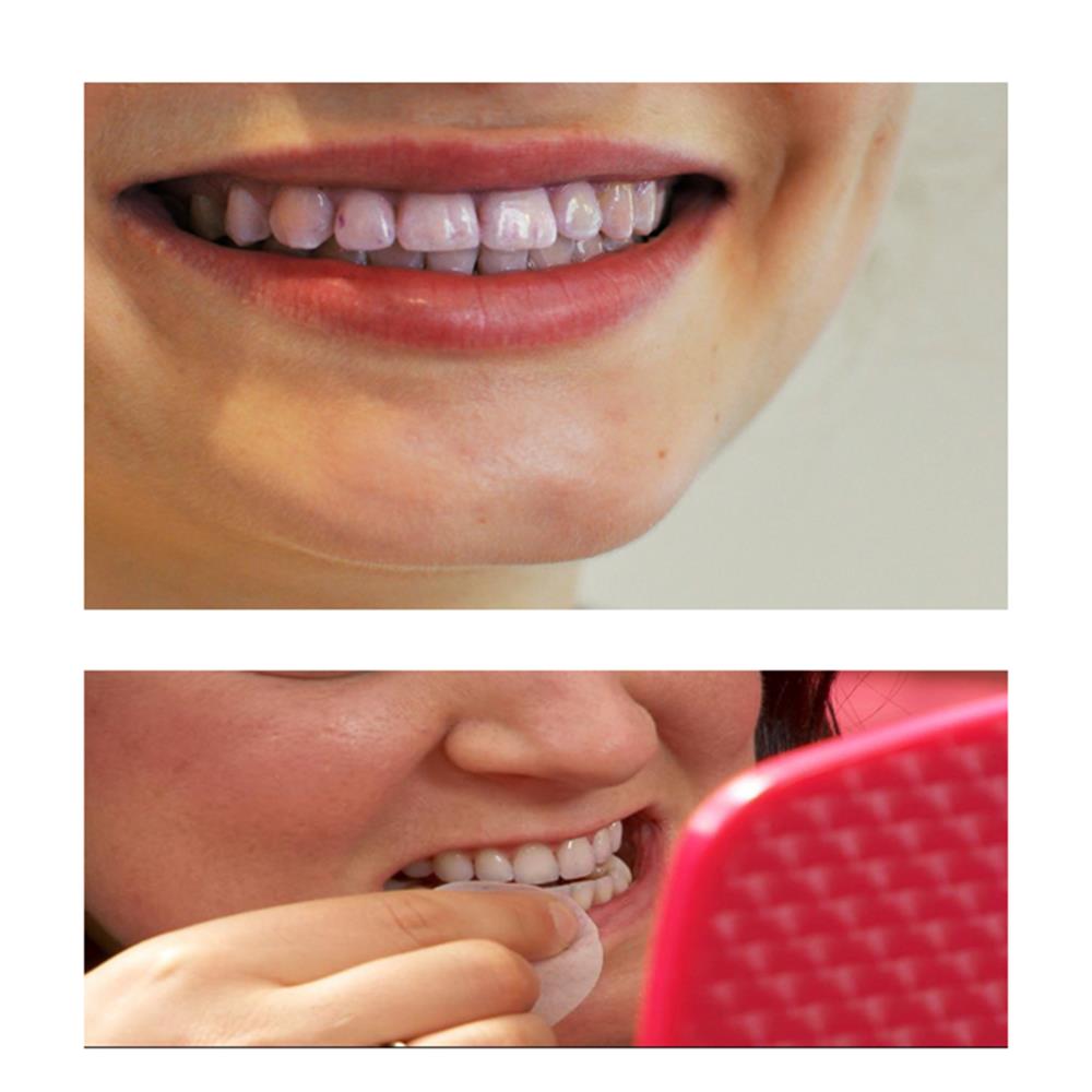 Pearly Wipes - Removes Stains from Teeth - Teeth Whitener Wipes ...