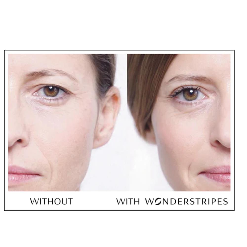 WONDERSTRIPES - First eyelid lifting without surgery!